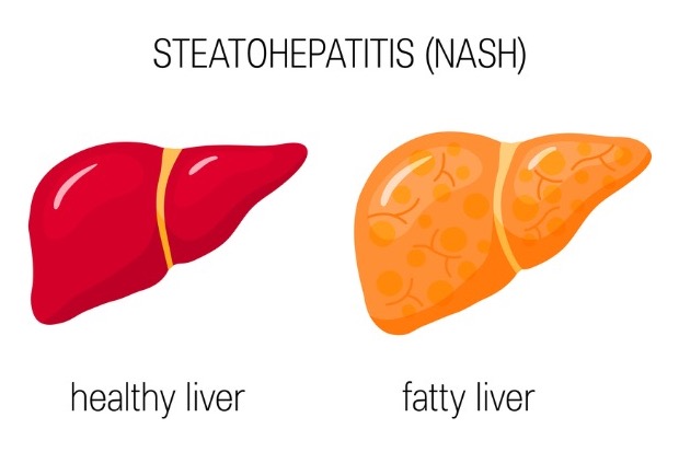 Studypages - A Study of the Safety and Effectiveness of Experimental ...