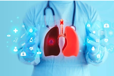Studypages - The PROACT LUNG Study