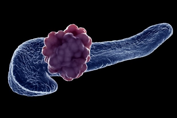 Studypages - A Study of Experimental NGM120 Combination Therapy for ...