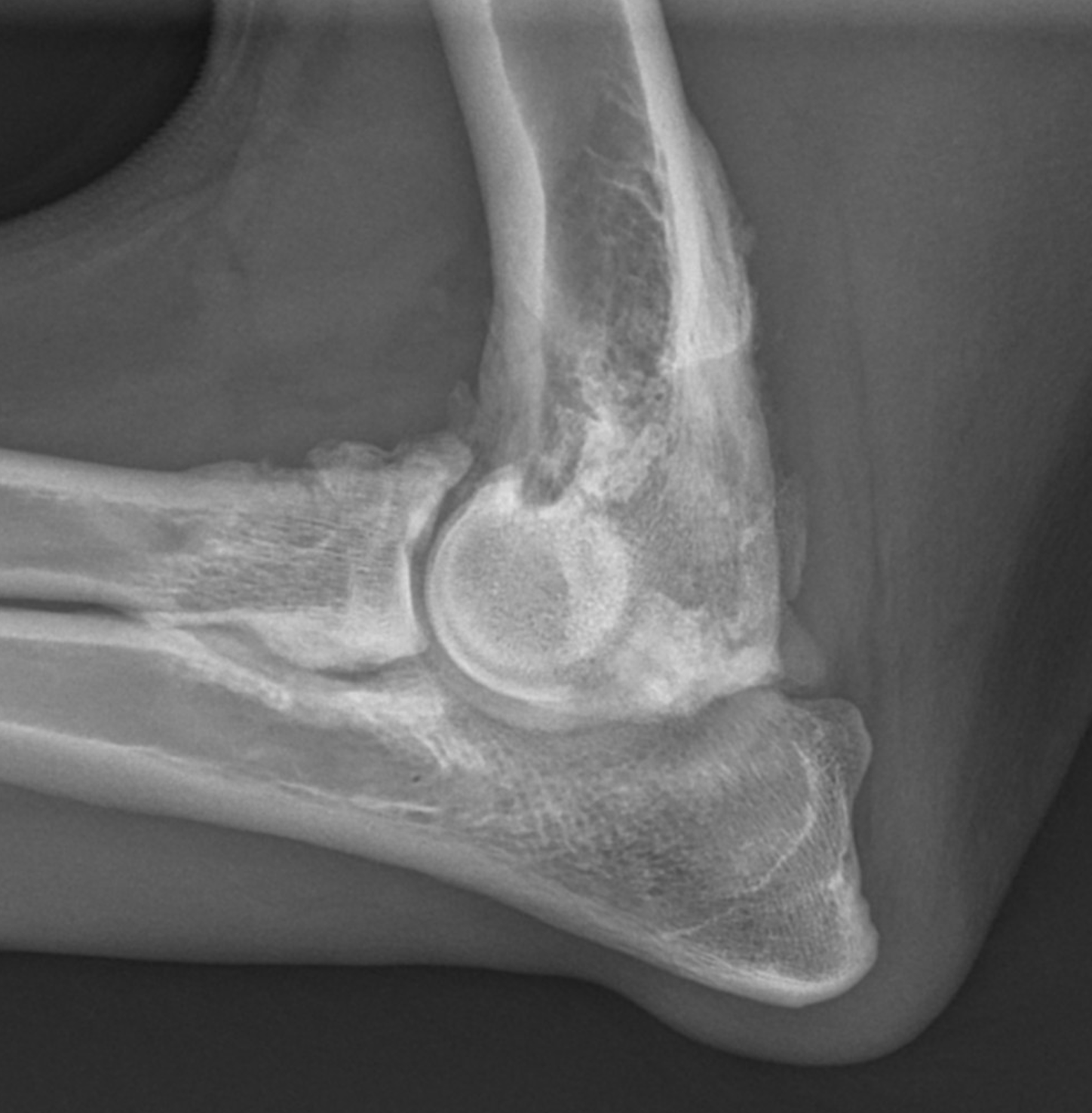 Studypages - Treatment response to an intra-articular injection of 2.5% ...