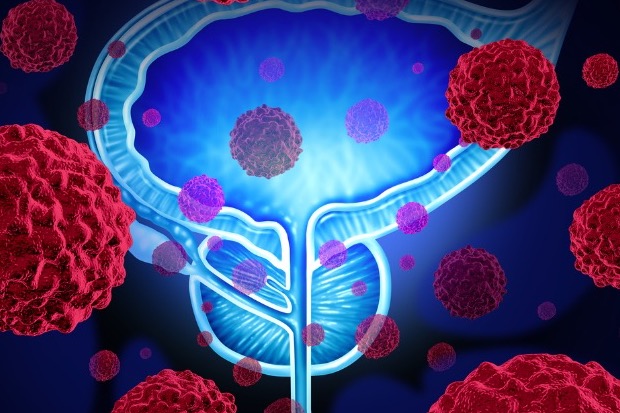Studypages - Two different types of radiotherapy, and hormone therapy ...