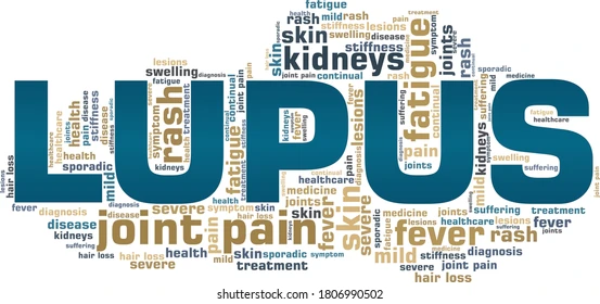 Studypages - RESET-SLE: CAR T-Cell Therapy for Lupus