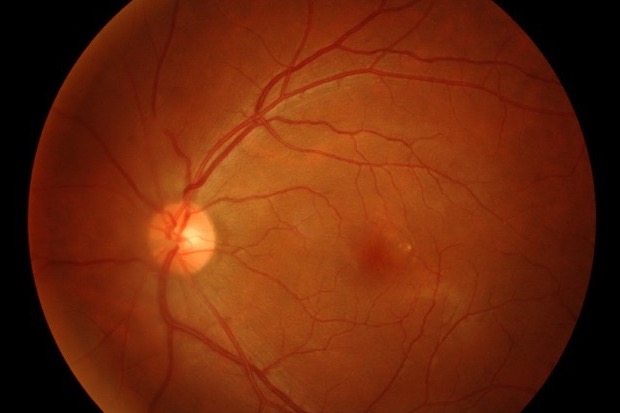 Studypages - Spectroscopic optical coherence tomography (OCT), to ...